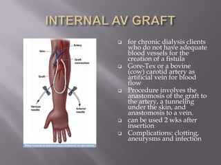 Chronic renal failure, surgical management | PPTX