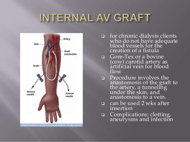 Chronic renal failure, surgical management