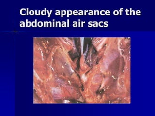 Chronic Respiratory Disease.ppt