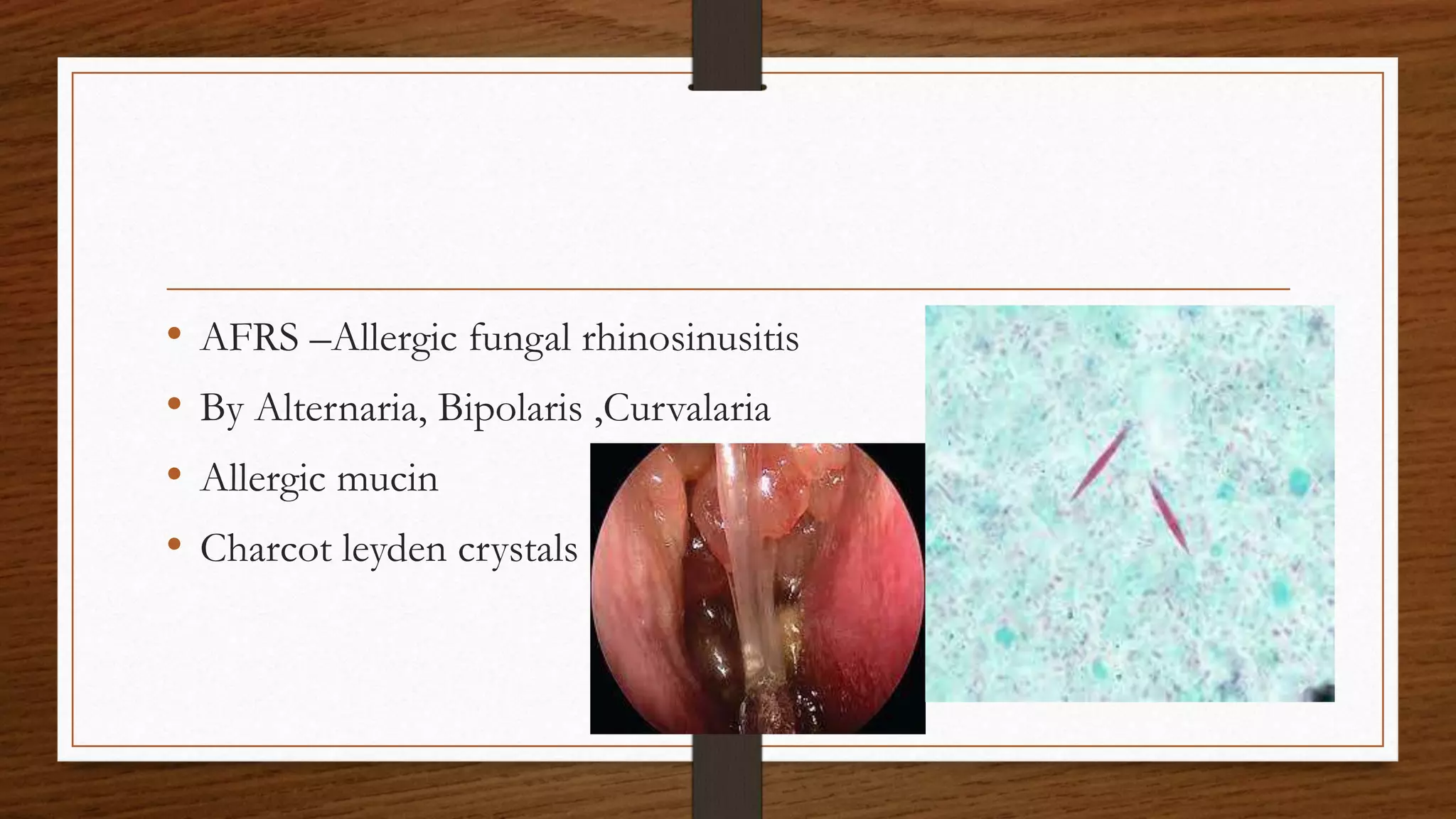 CHRONIC RHINOSINUSITIS.pptx