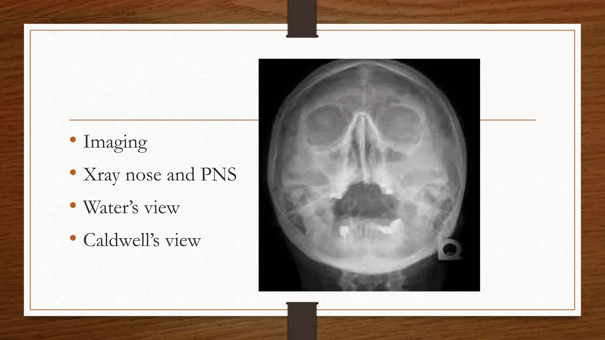 CHRONIC RHINOSINUSITIS.pptx