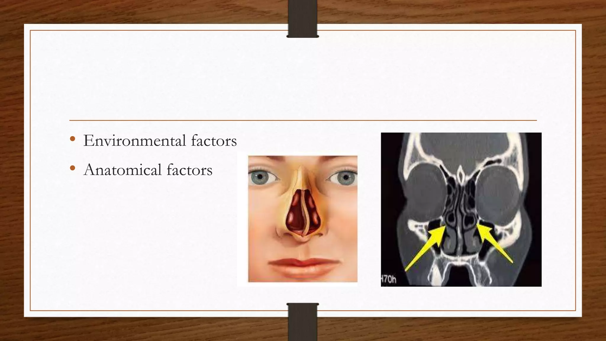 CHRONIC RHINOSINUSITIS.pptx