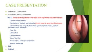 CHRONIC RHINOSINUSITIS AND NASAL POLYP .pptx