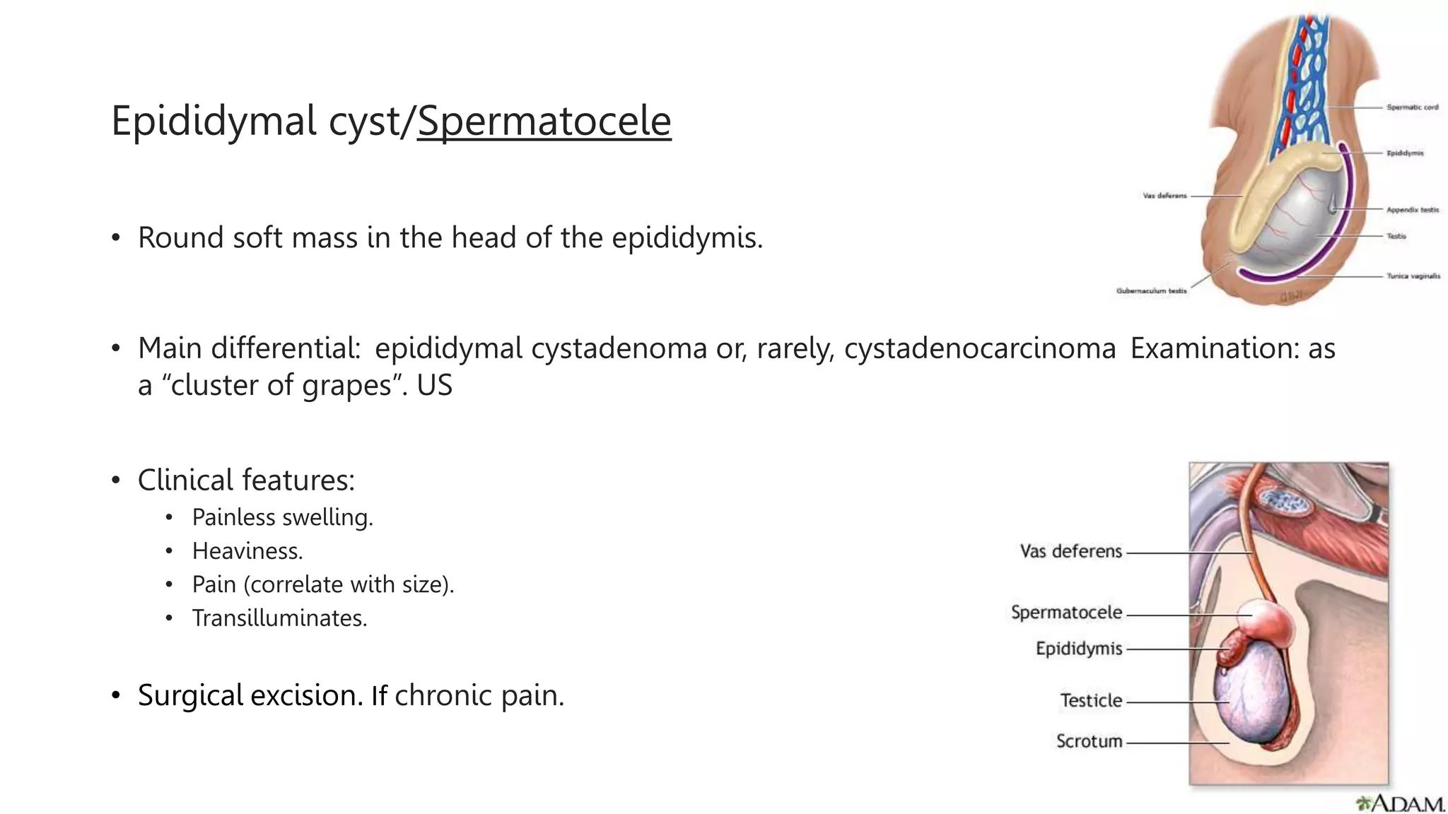 chronic scrotal pain.pptx | Infertility | Reproductive Health