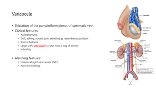 chronic scrotal pain.pptx | Infertility | Reproductive Health