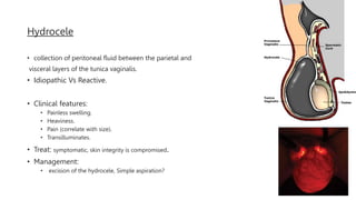chronic scrotal pain.pptx | Infertility | Reproductive Health