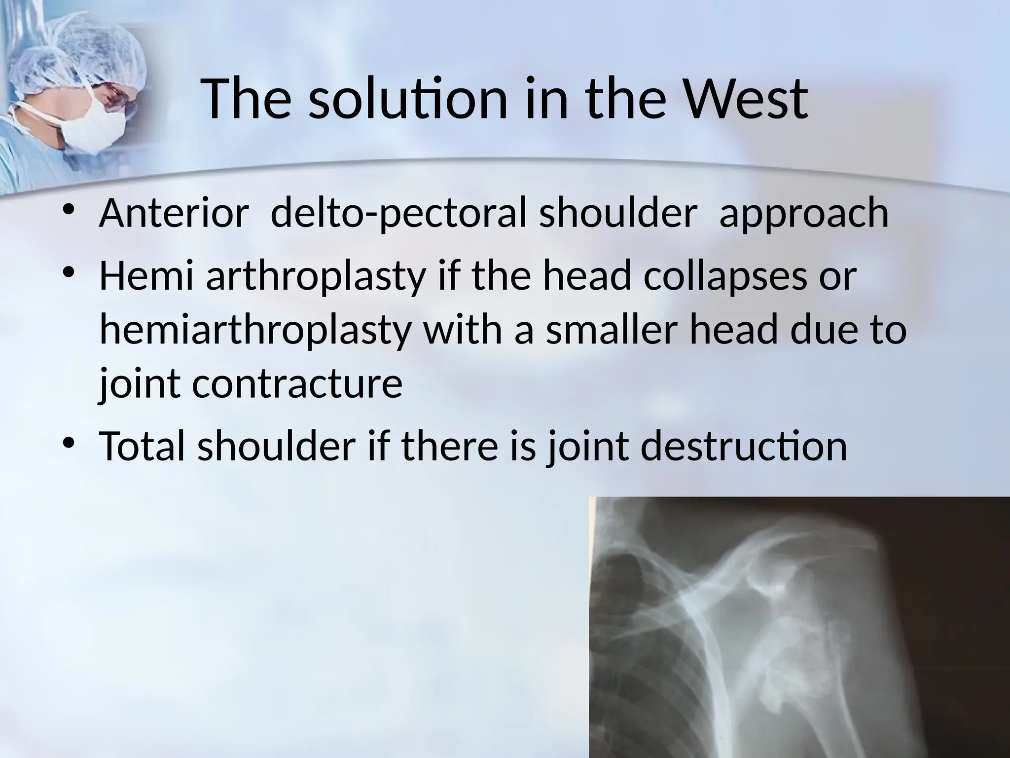 Chronic shoulder dislocation, bedru2020.pptx