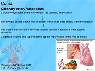 Chronic stable angina | PPTX
