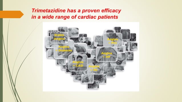 Chronic Stable Angina.pptx