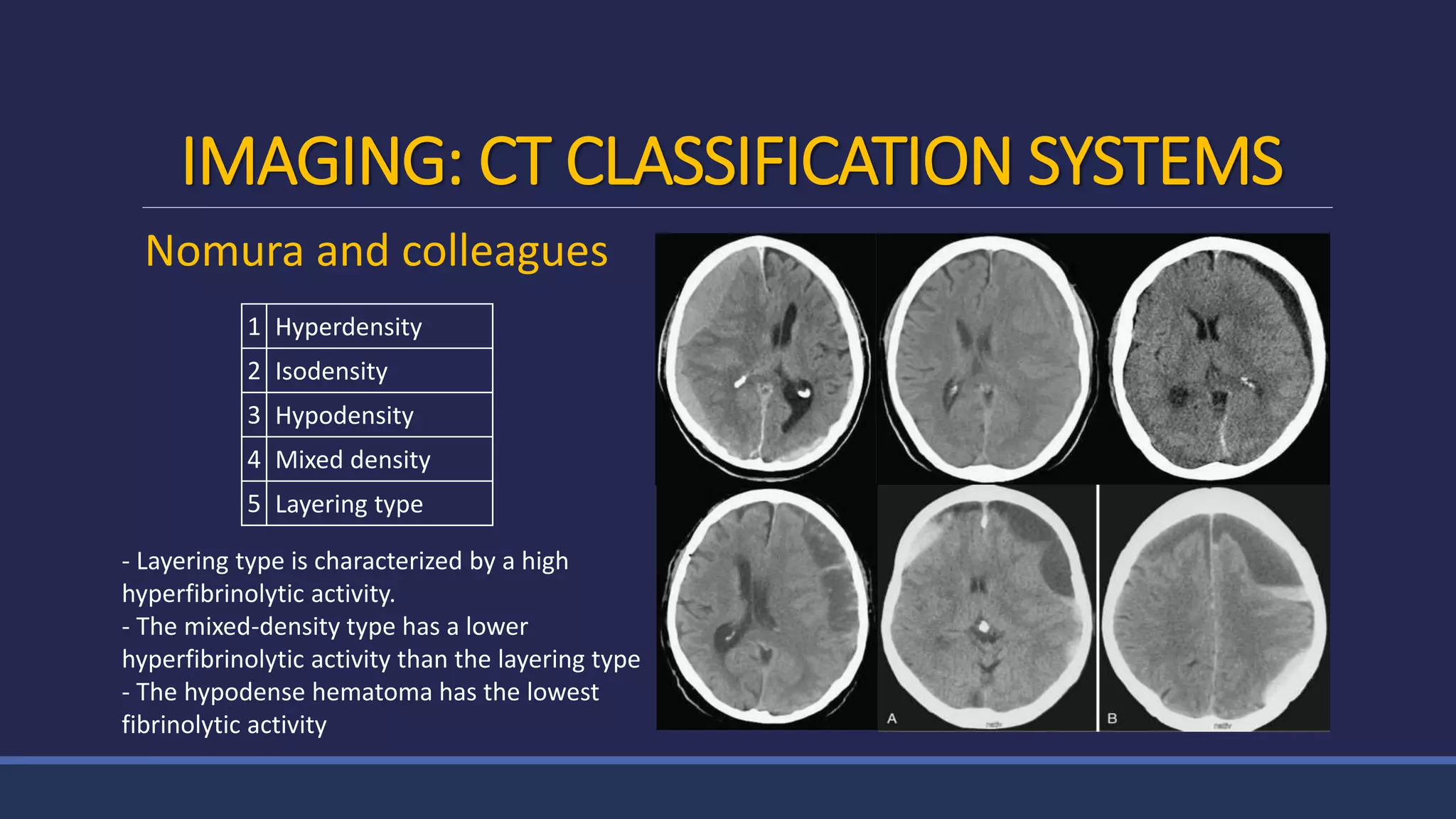 Chronic subdural hematoma | PPTX