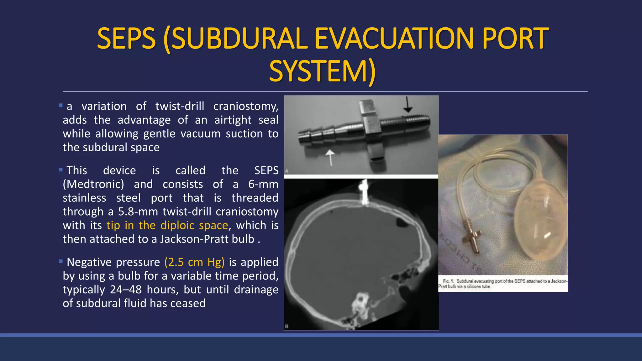 Chronic subdural hematoma | PPTX