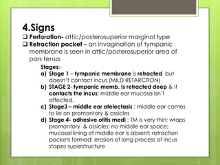 Chronic suppurative otitis media | PPTX
