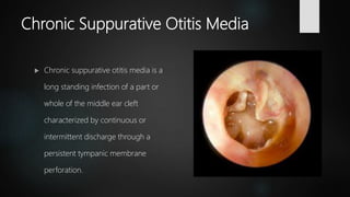 CHRONIC SUPPURATIVE OTITIS MEDIA.pptx