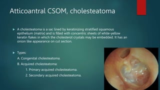 Chronic suppurative otitis media.pptx