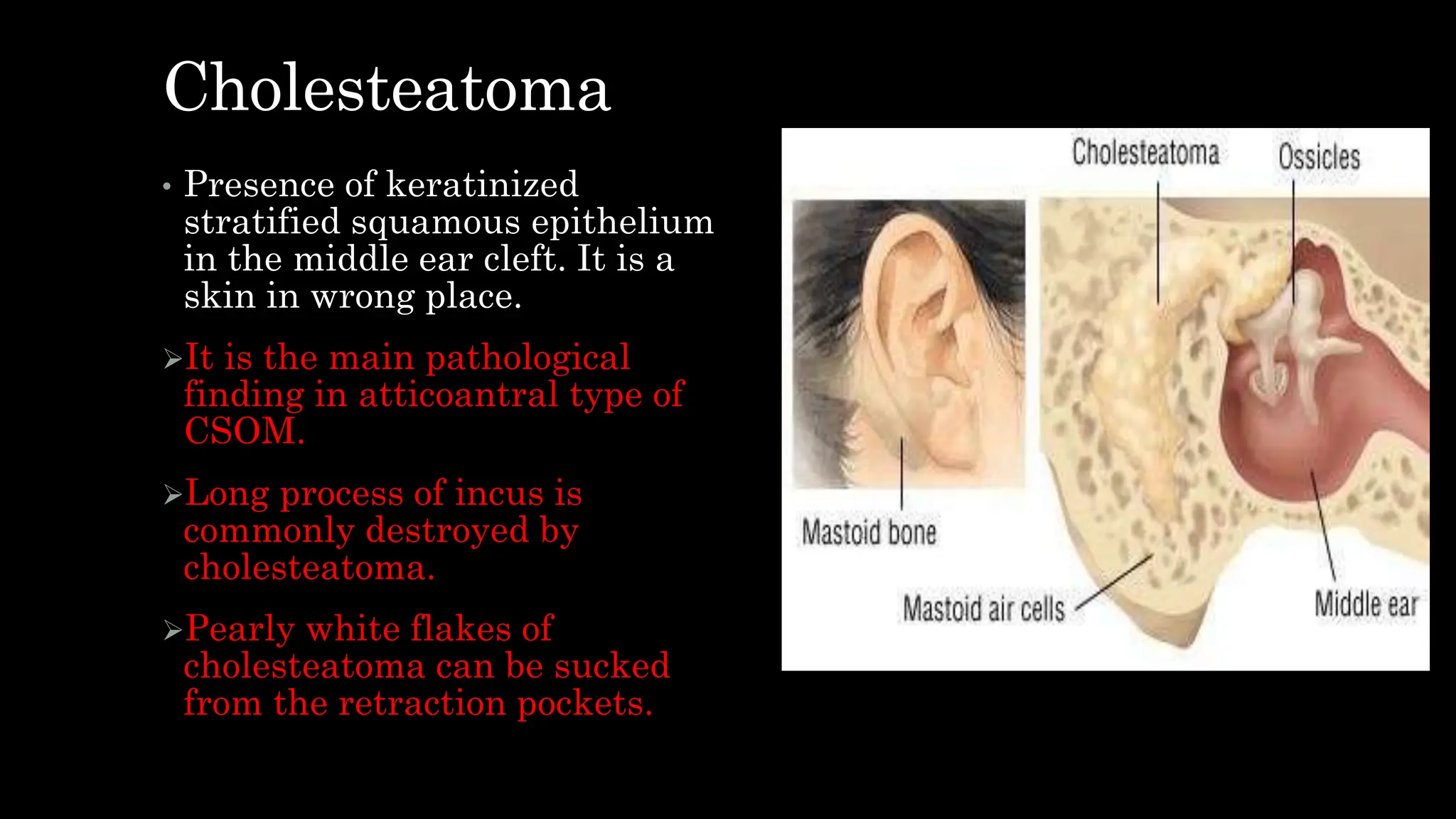 Chronic Suppurative Otitis Media (CSOM) | PPTX | Ear, Nose and Throat ...