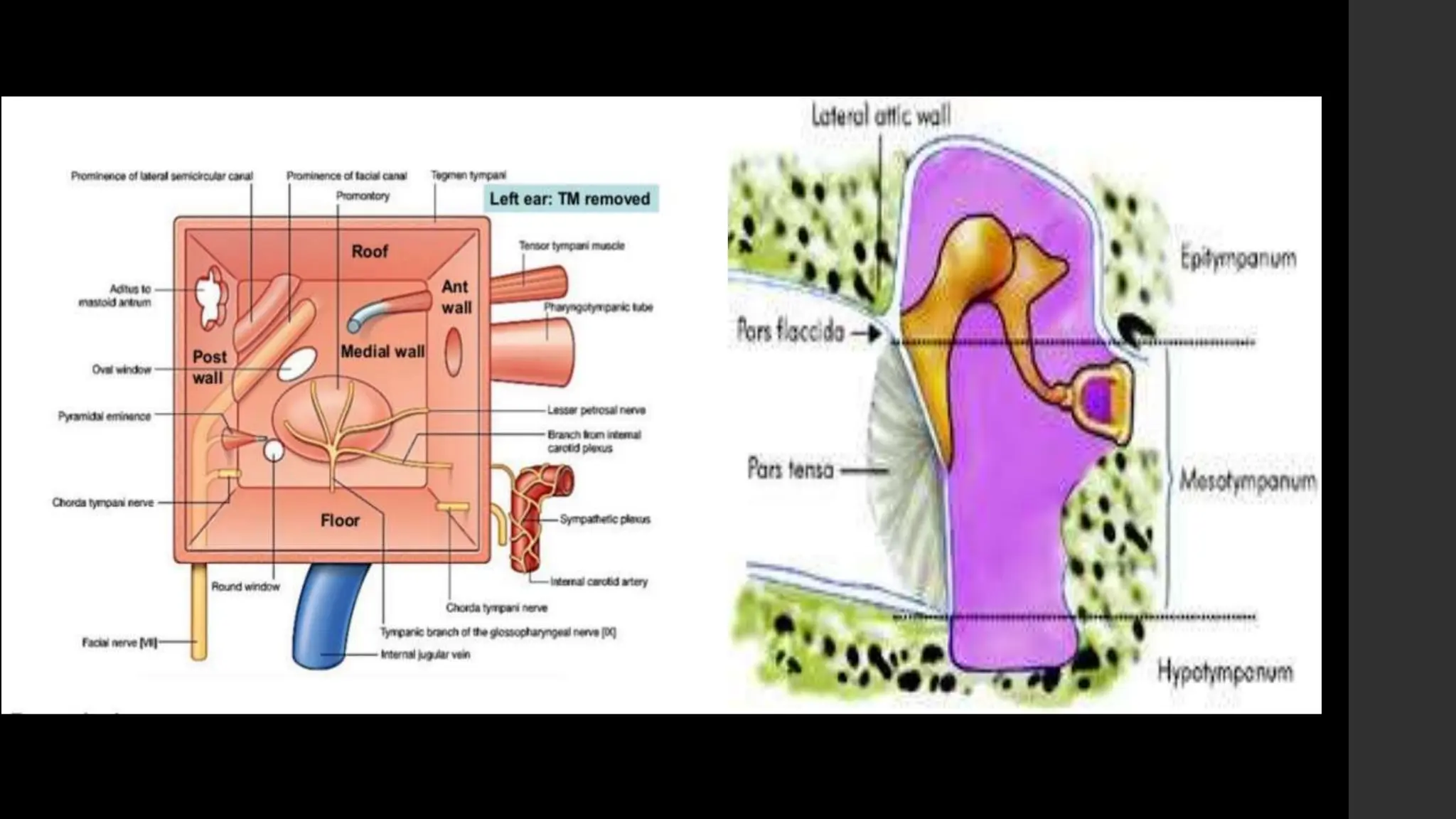 Chronic Suppurative Otitis Media (CSOM) | PPTX | Ear, Nose and Throat ...