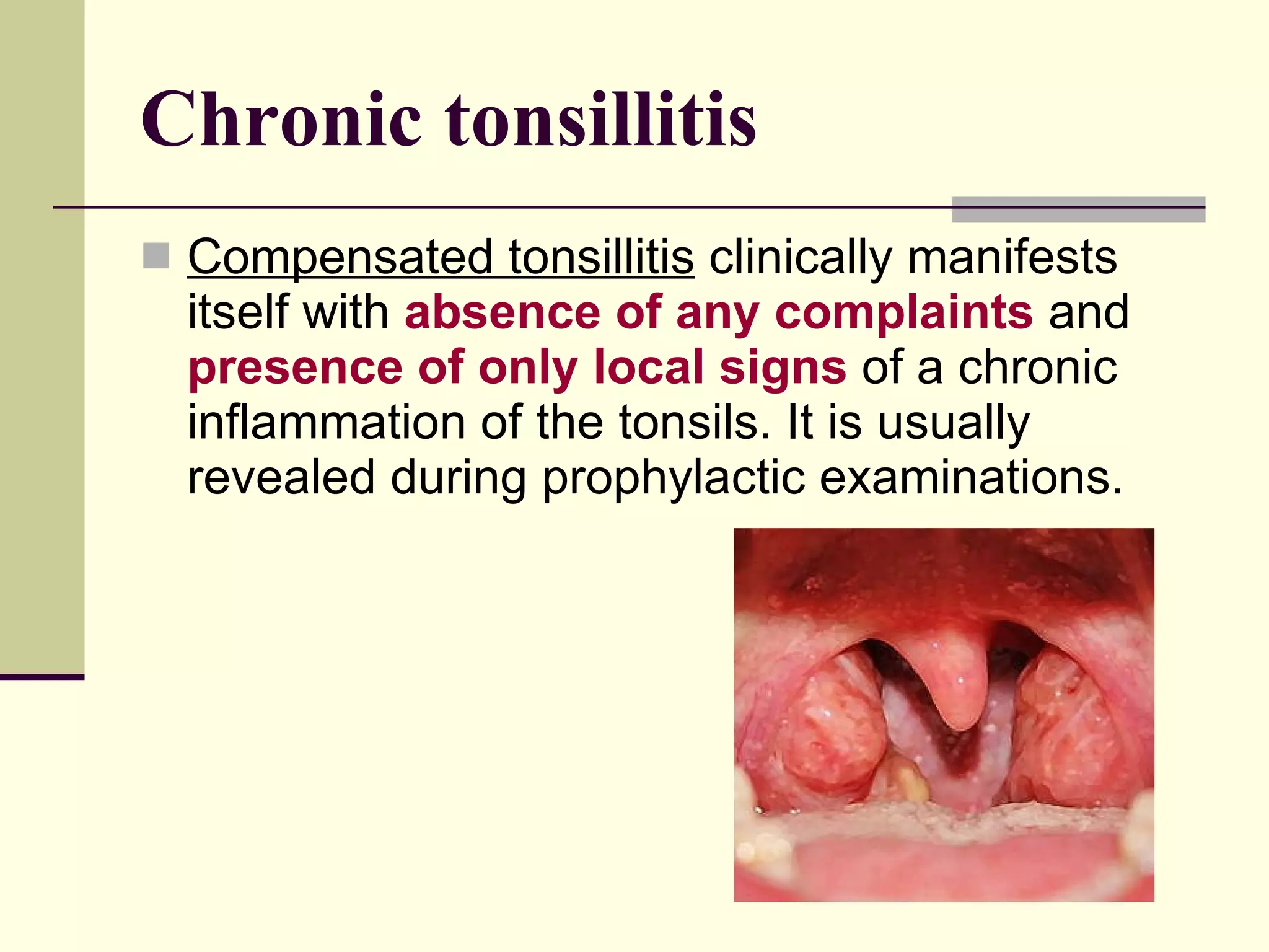 Chronic tonsillitis | PPT