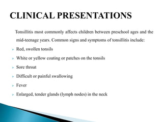 Chronic tonsillitis | PPTX