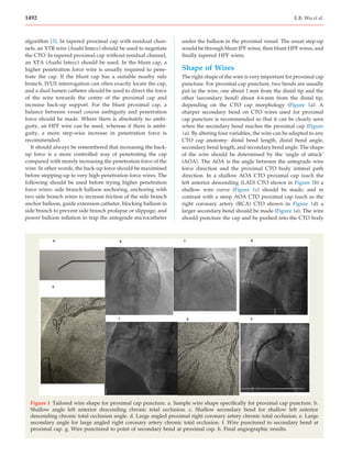 Chronic total occlusion wiring | PDF