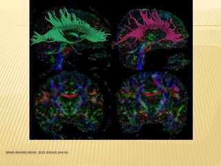 Chronic Traumatic Encephalopathy | PPTX