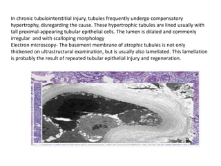 Chronic tubulointerstial nephrities | PPTX