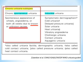 Chronic urticaria how to approach | PPT