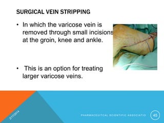 Chronic venous disease | PPTX