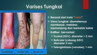 VariseS Tungkai Insuffisiensi Vena Kronis.pptx