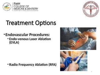 CHRONIC VENOUS DISEASES: A COMMON VENOUS DISORDER | PPT