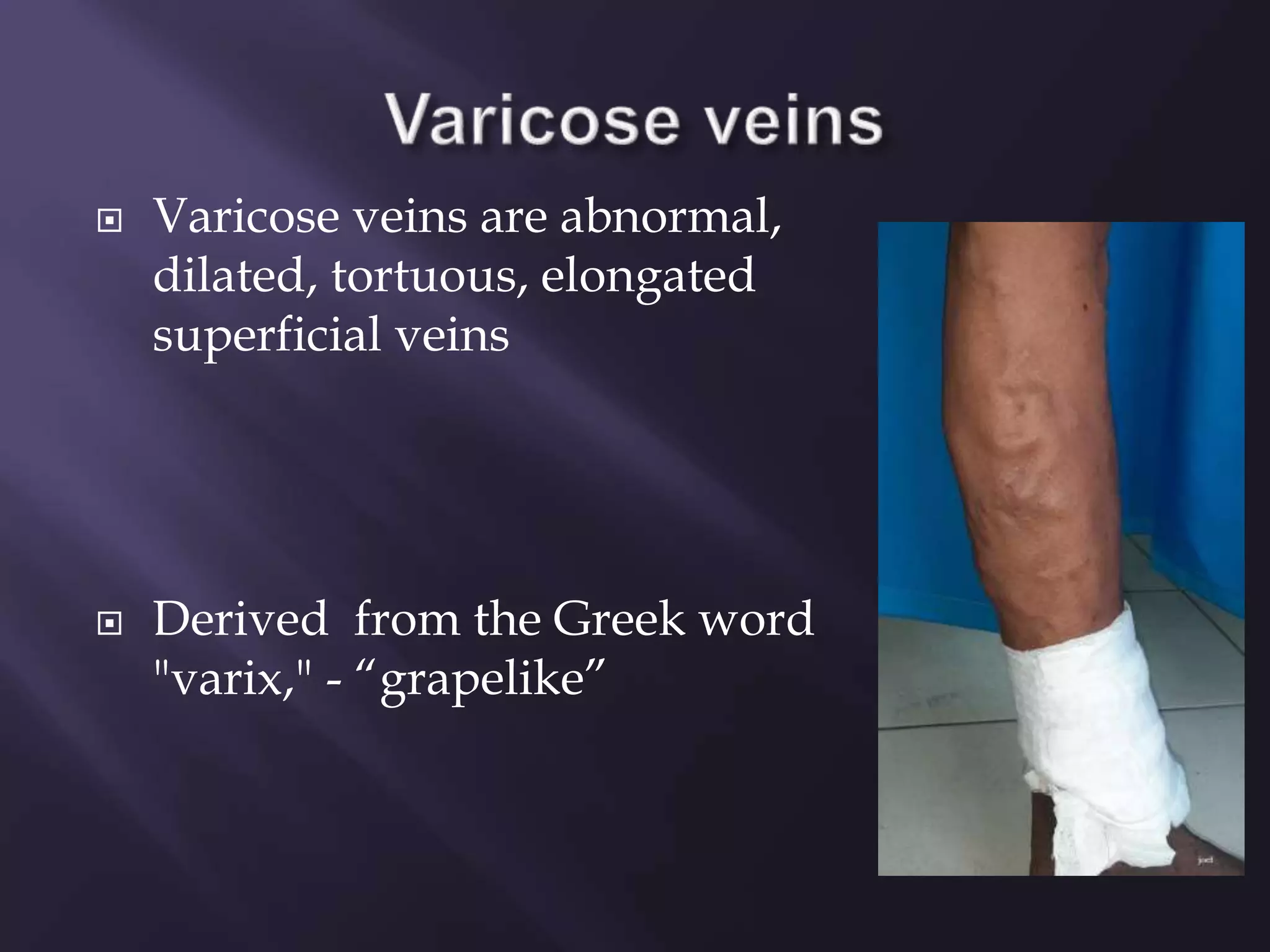 Chronic venous disease 2020 | PPT