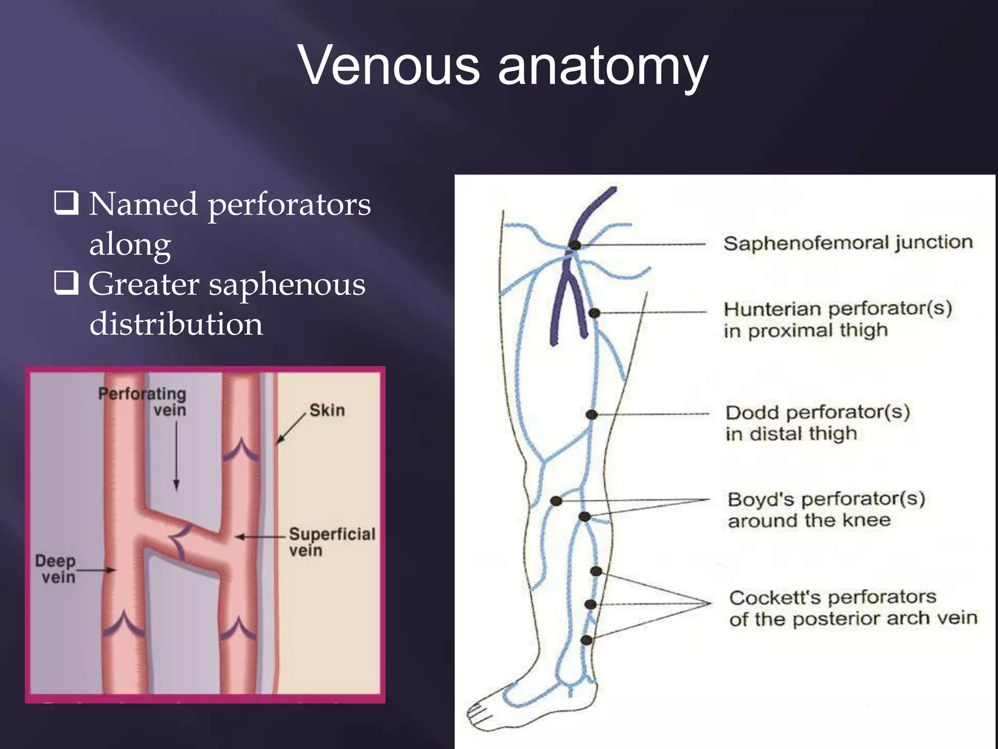 Chronic venous disease 2020 | PPT