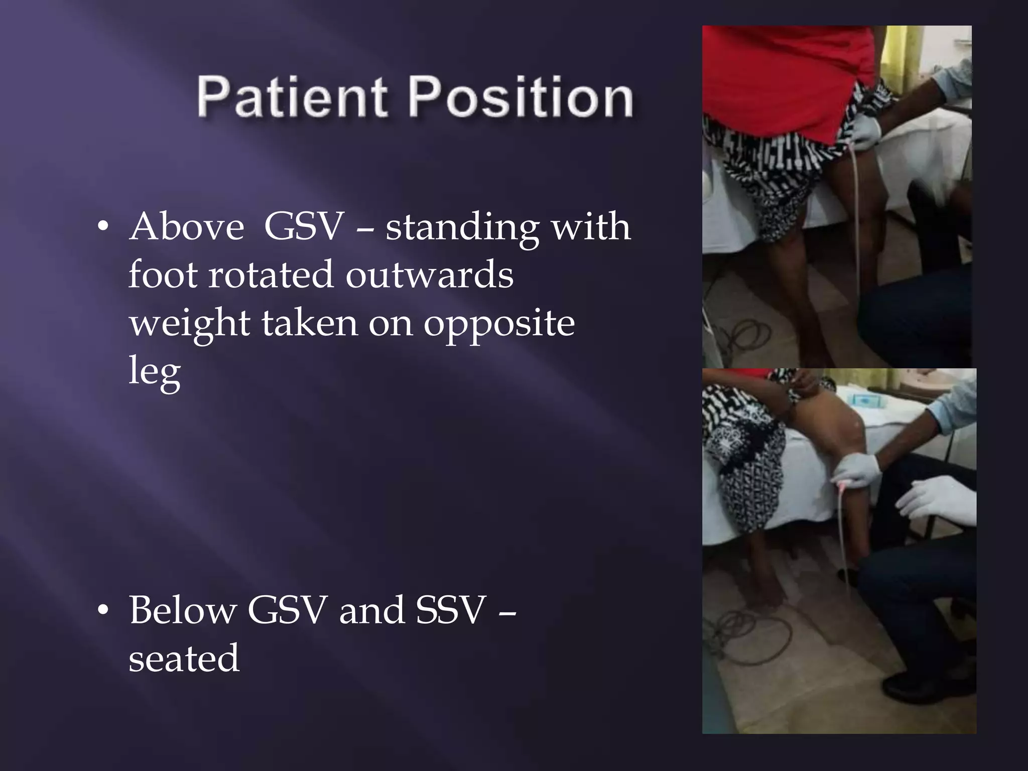 Chronic venous disease 2020 | PPT