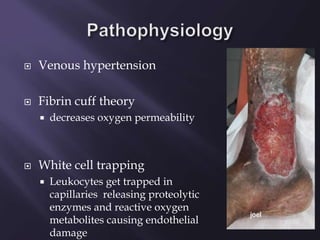 Chronic venous disease 2020 | PPT