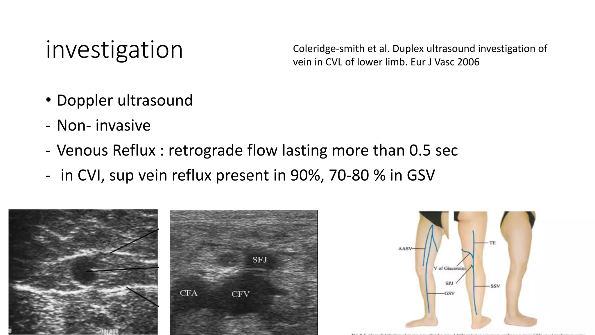 Chronic venous insufficiency | PPTX