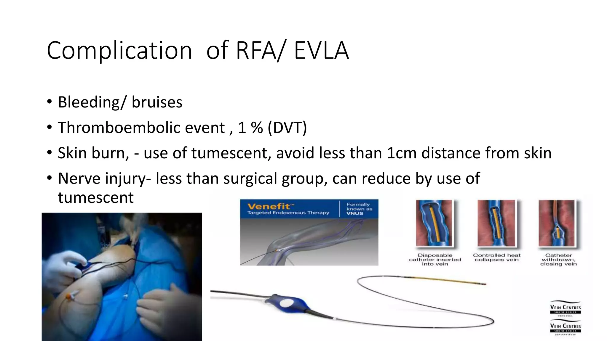 Chronic venous insufficiency | PPTX