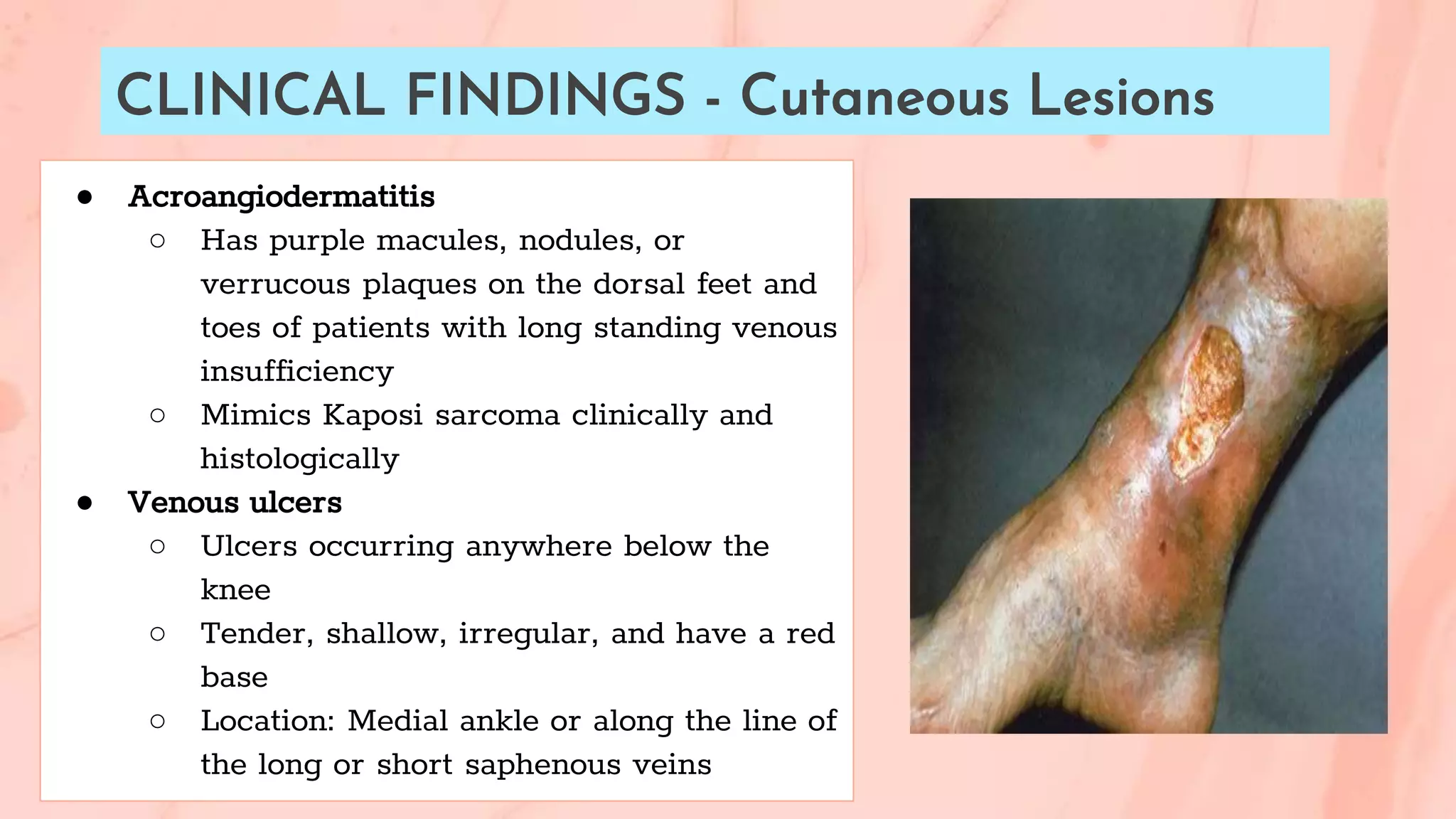 Chronic Venous Insufficiency (drive).pptx