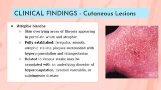 Chronic Venous Insufficiency (drive).pptx