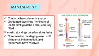 Chronic Venous Insufficiency (drive).pptx
