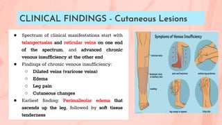 Chronic Venous Insufficiency (drive).pptx