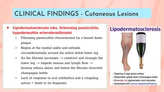 Chronic Venous Insufficiency (drive).pptx