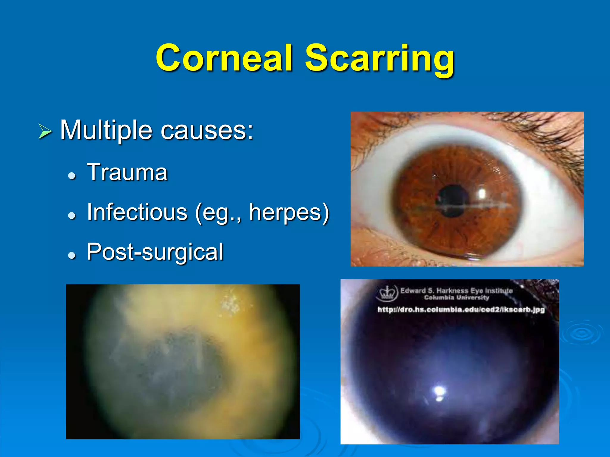 Chronic visual loss | PPTX