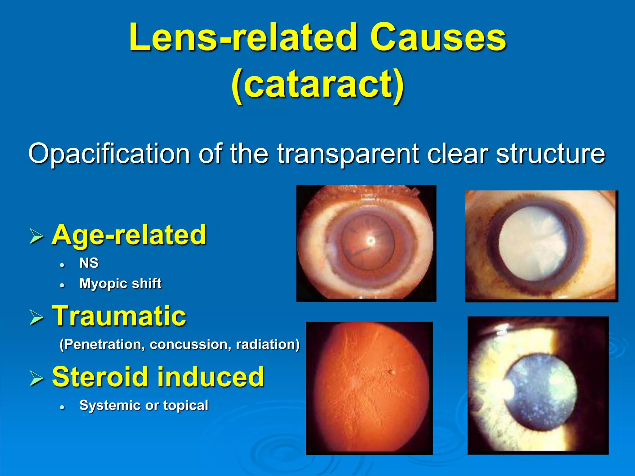 Chronic visual loss | PPTX