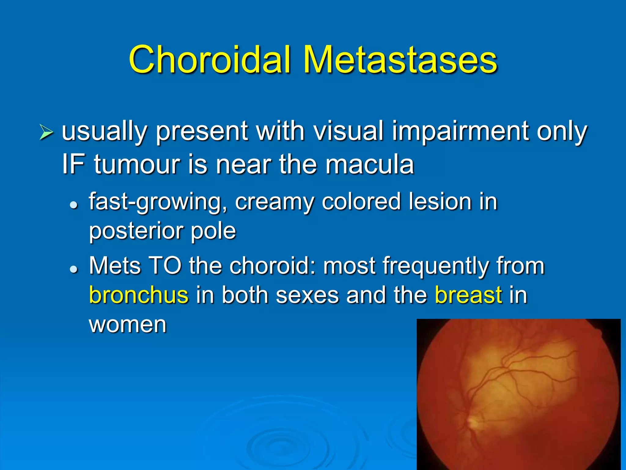 Chronic visual loss | PPTX