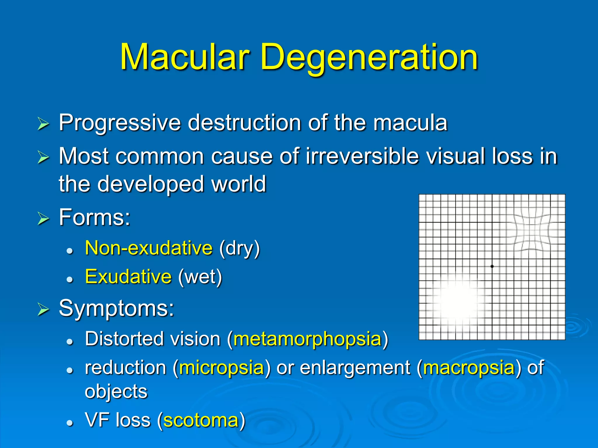 Chronic visual loss | PPTX
