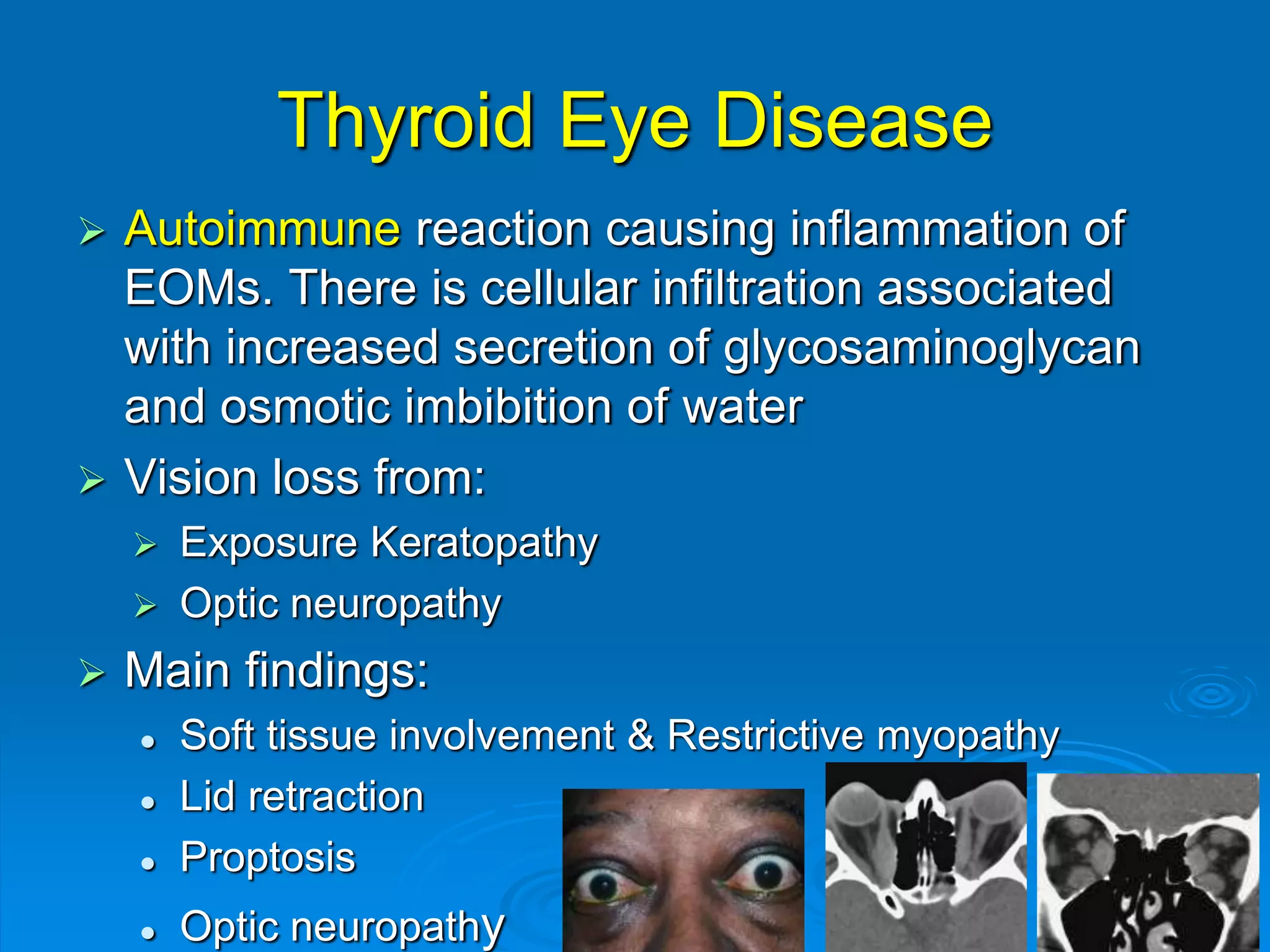 Chronic visual loss | PPTX