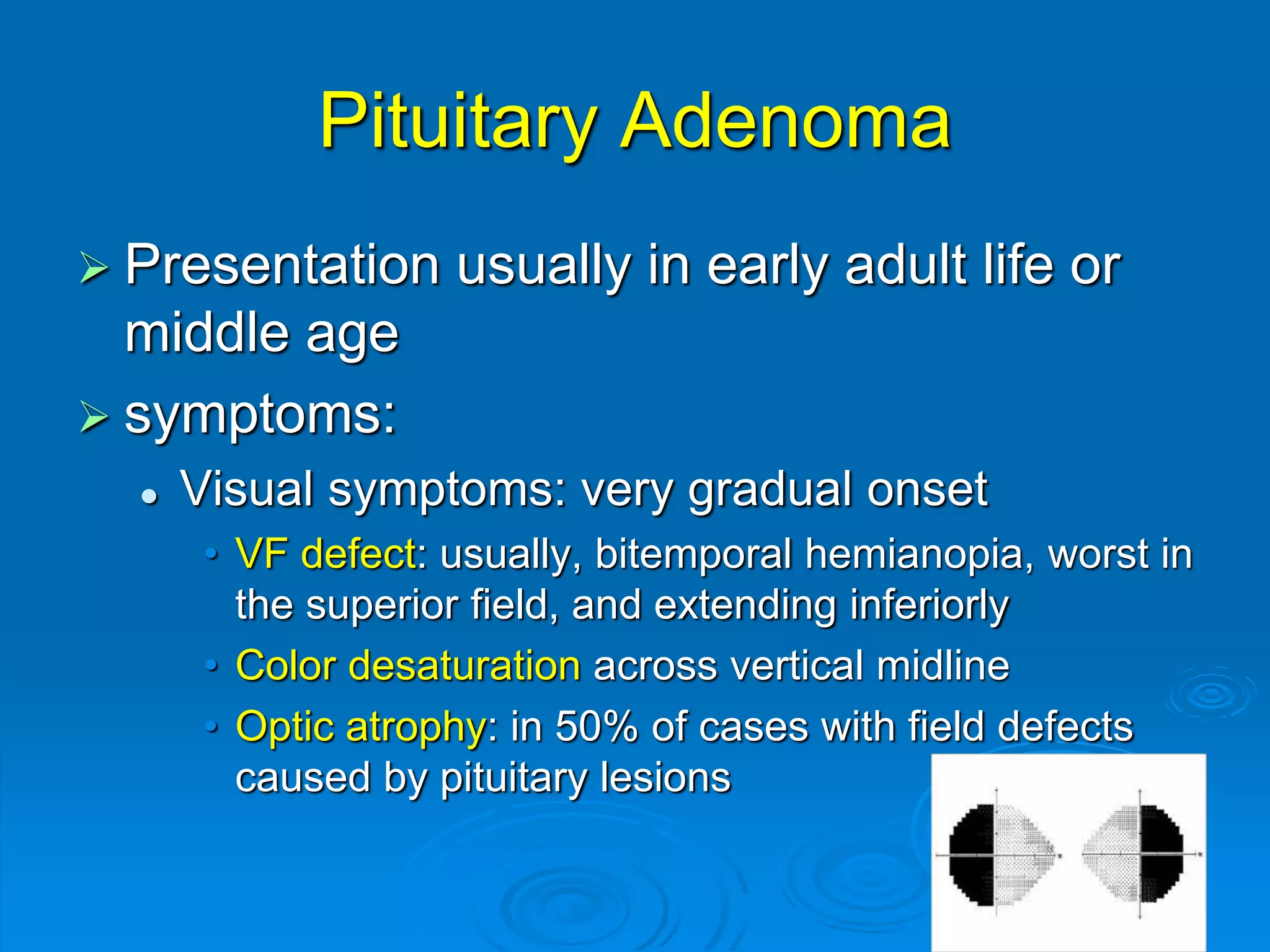 Chronic visual loss | PPTX