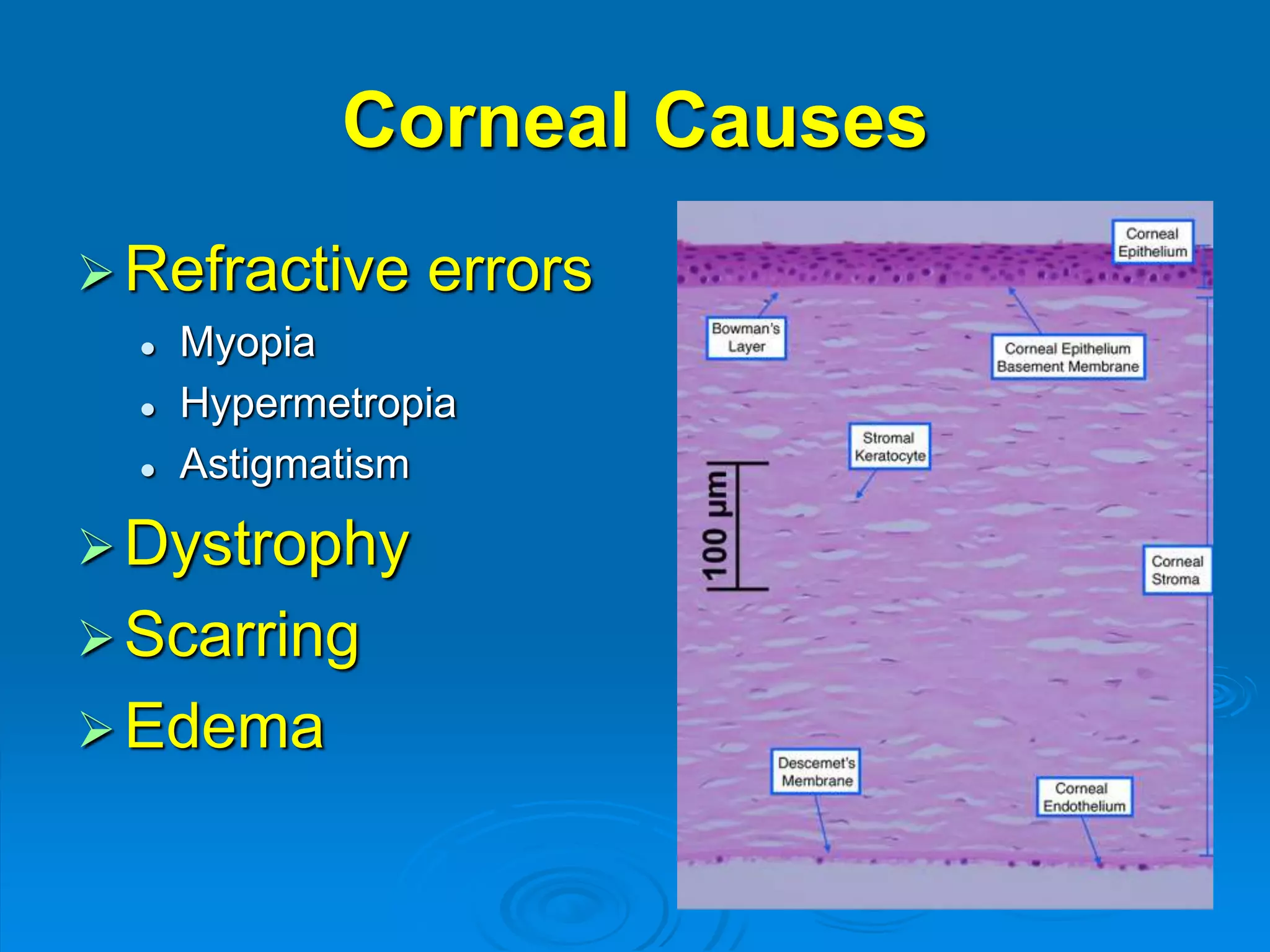 Chronic visual loss | PPTX
