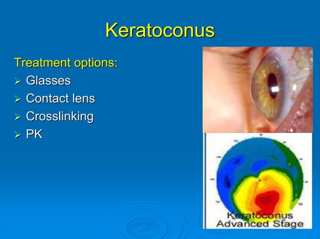 Chronic visual loss | PPTX
