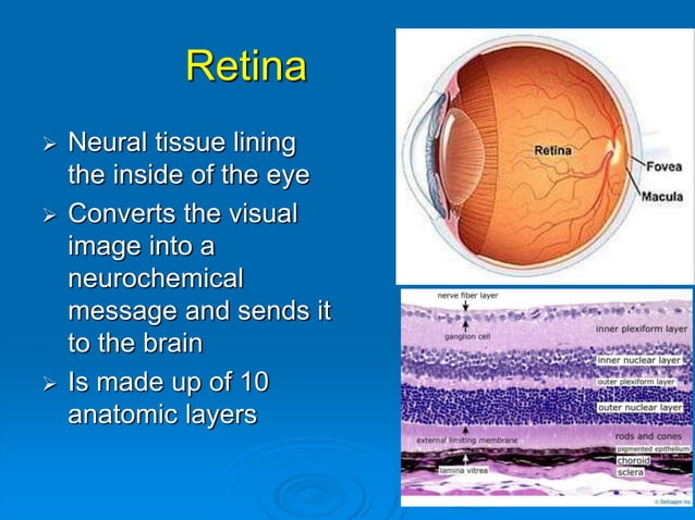 Chronic visual loss | PPTX