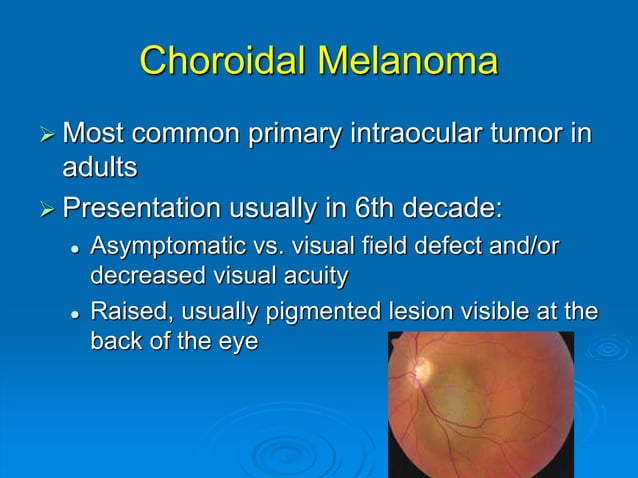 Chronic visual loss | PPTX